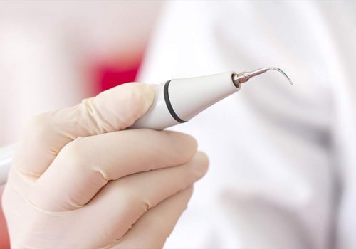 Détartrage - Centre dentaire du château